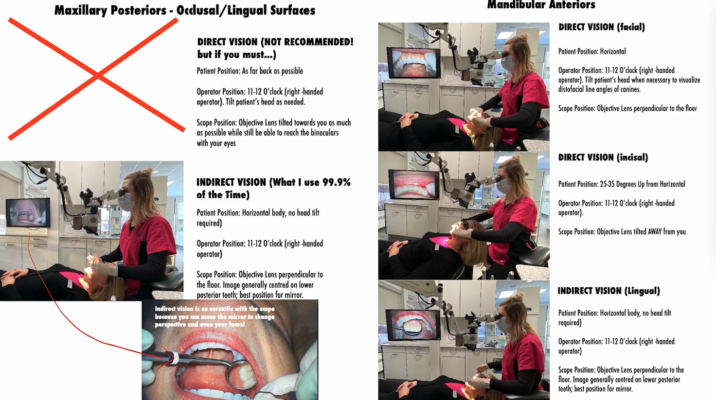 How to Position Your Dental Microscope